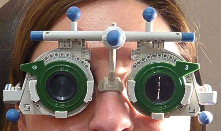 Réfraction manuelle sur kératocône : méthode de la fente sténopéique