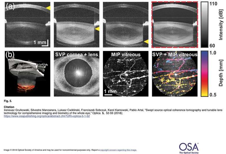 Un nouveau type d’OCT pour une image détaillée de l’œil entier